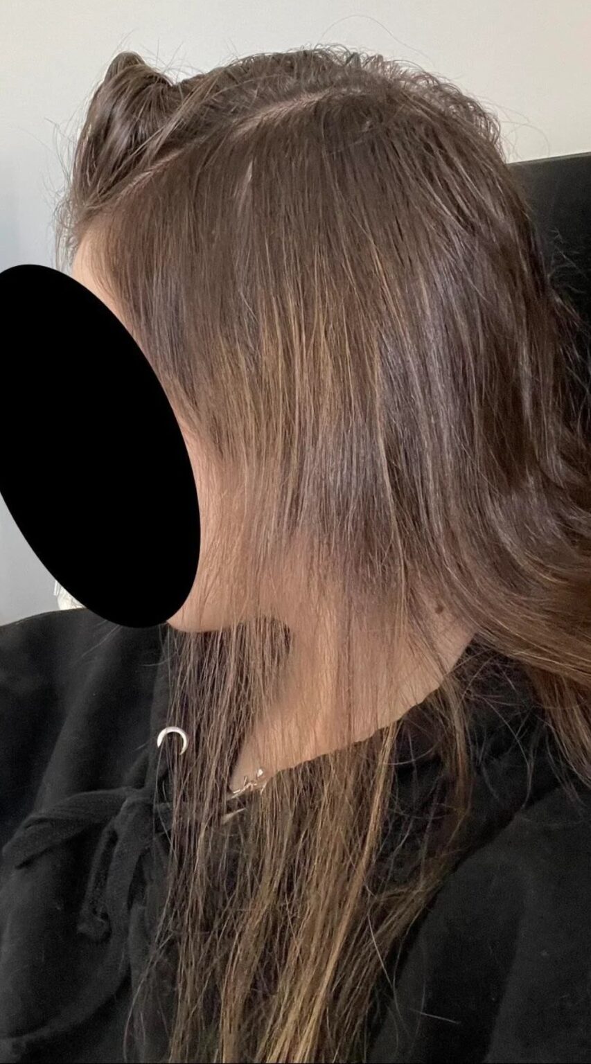 How to Stop Thinning Hair in Women: Proven Tips for Fuller Strands ...