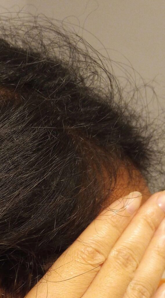 Why Does My Hair Dry Frizzy and Poofy? Understanding the Causes and ...