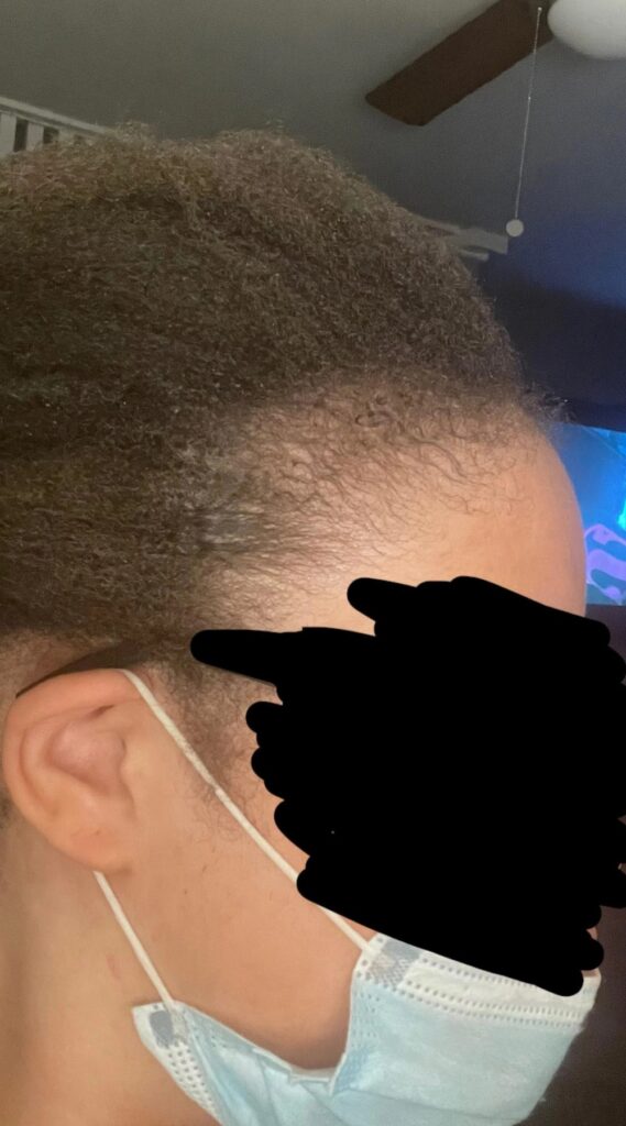 How to Grow Edges Back Fast: Tried and Tested Tips for a Fuller ...