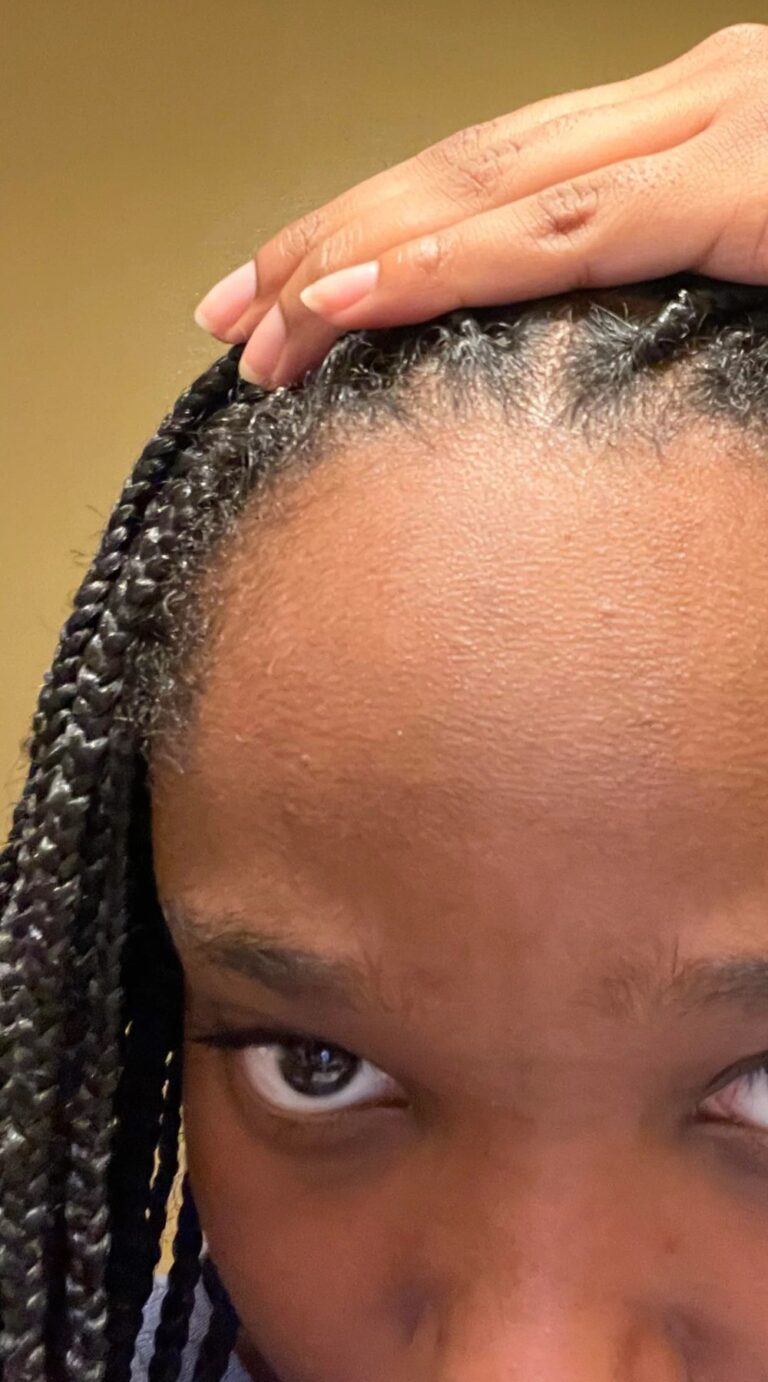How to Grow Edges Back Fast: Tried and Tested Tips for a Fuller ...