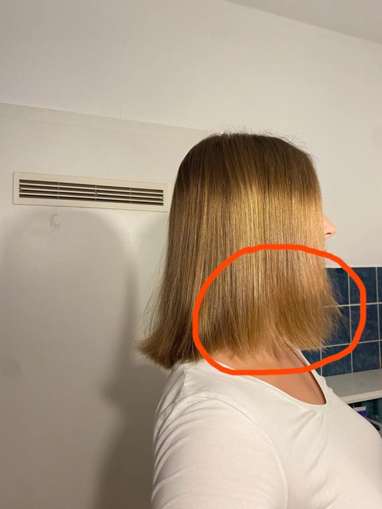 How to Fix Damaged Thin Hair: Simple Treatments That Actually Work ...
